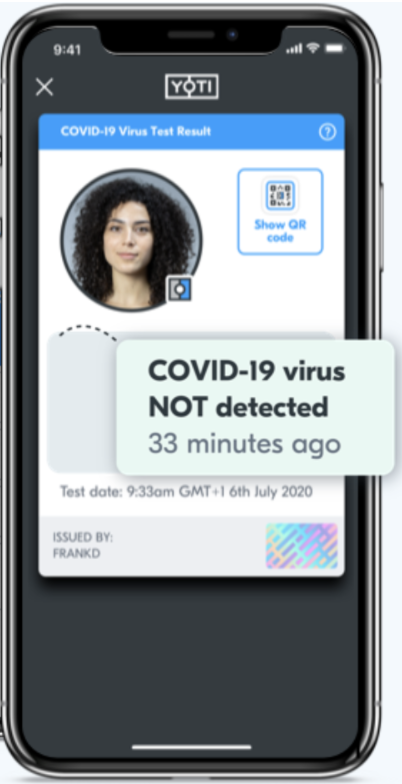 How can I check my test results?